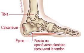 Vous avez mal au talon au réveil ? Voici ce que vous devez savoir et ...